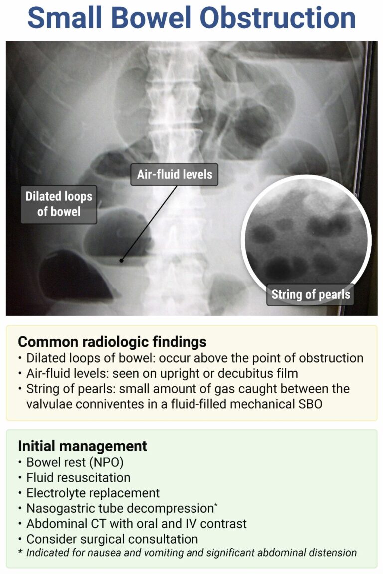 EM@3AM: Inflammatory Bowel Disease - emDocs